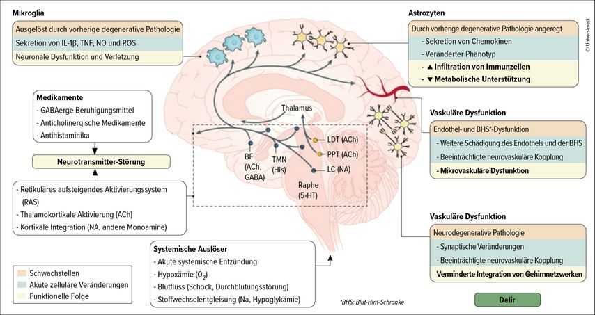 Was steckt hinter dem Delir? - Neurologie - Universimed - Medizin im Fokus